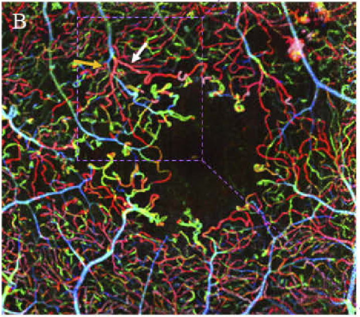 A representative OCT-A image acquired from a human eye is shown in the ...